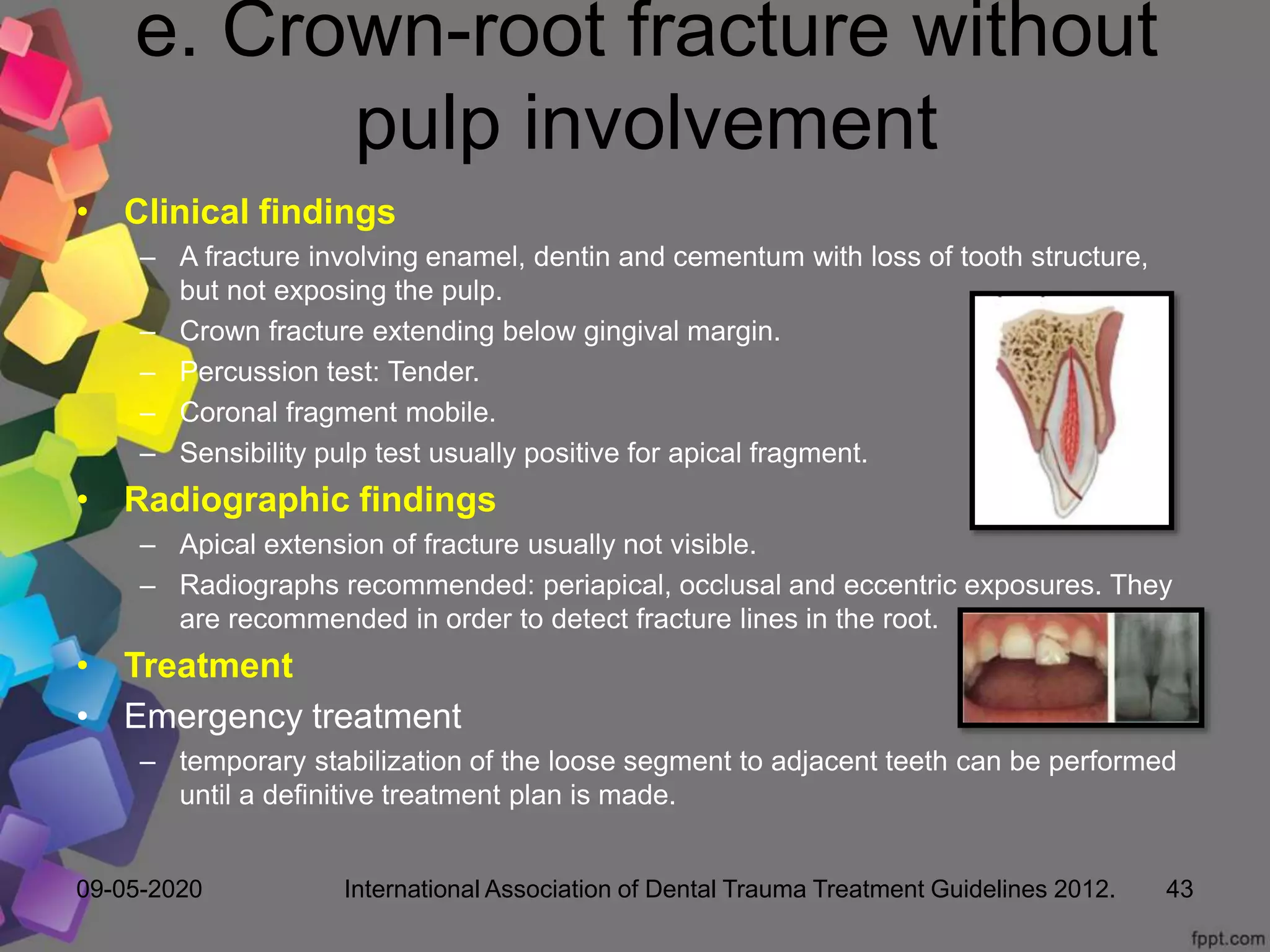 Traumatic Dental Injuries to Permanent Teeth | PPT
