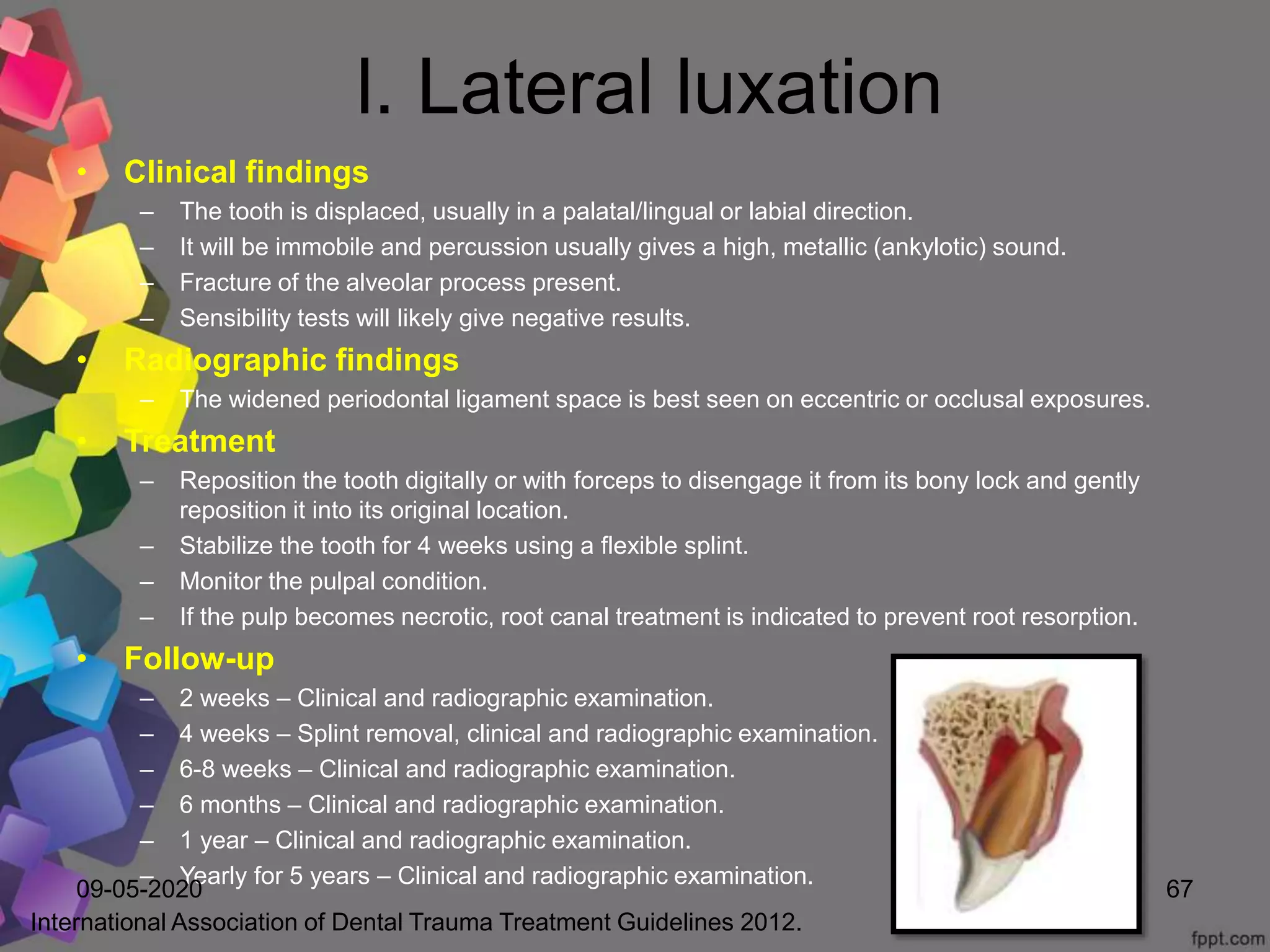Traumatic Dental Injuries to Permanent Teeth | PPT