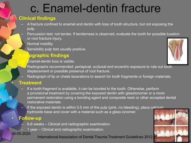Traumatic Dental Injuries to Permanent Teeth | PPT | Dental Health ...