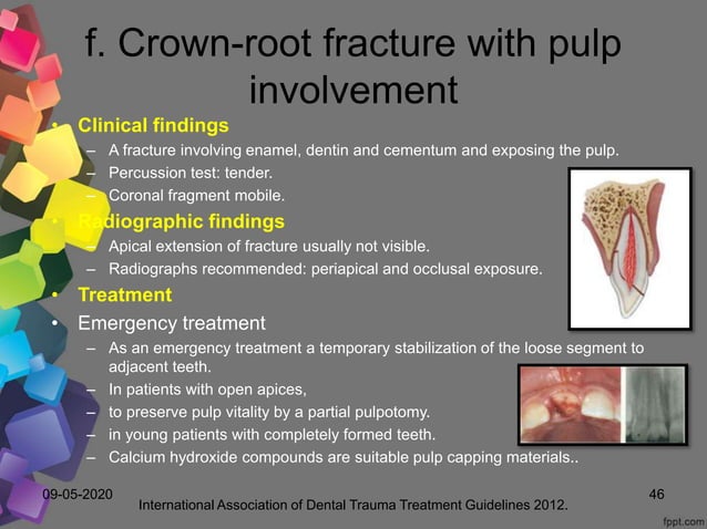 Traumatic Dental Injuries to Permanent Teeth | PPT | Dental Health ...