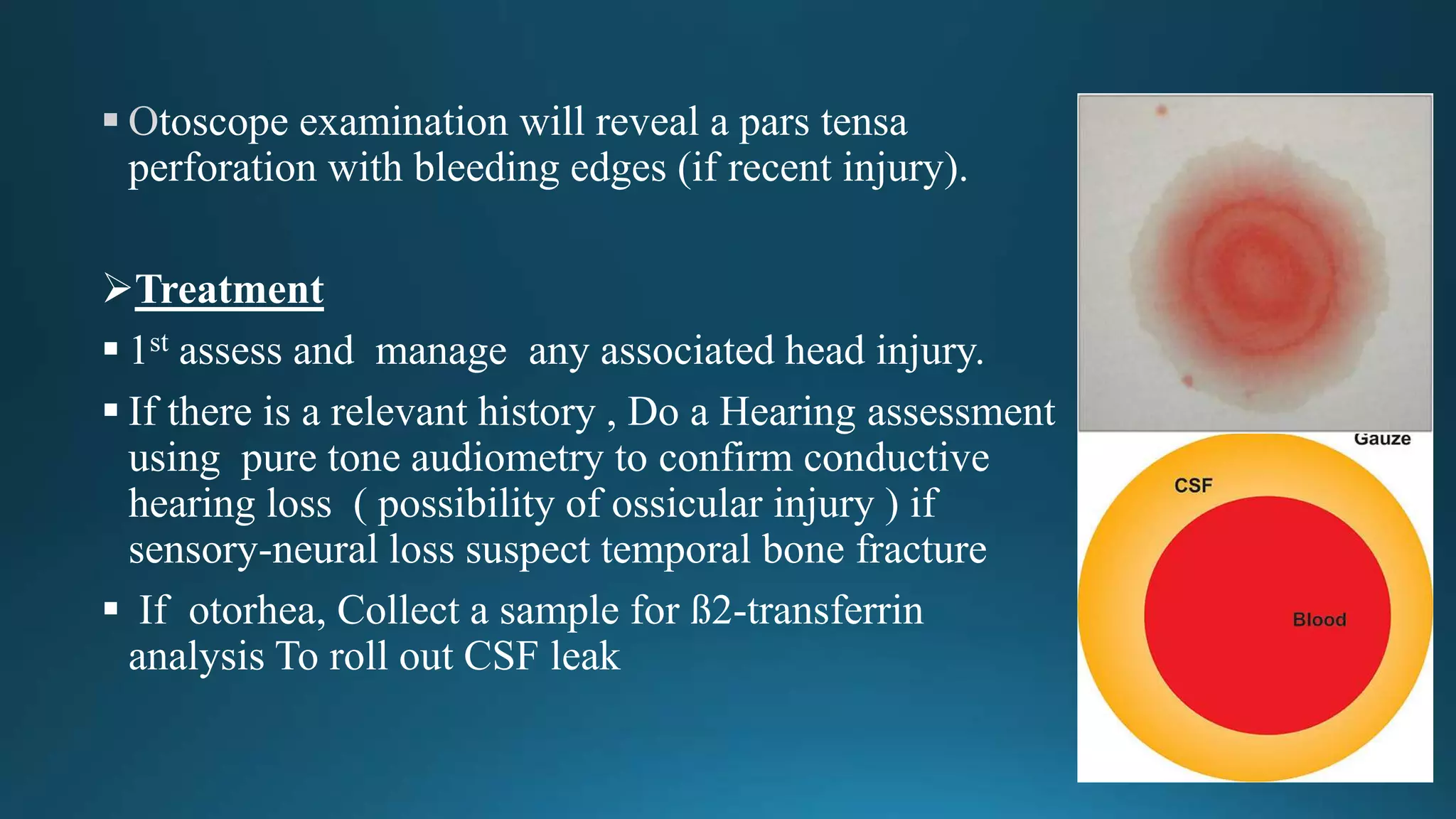 Traumatic ear | PPTX