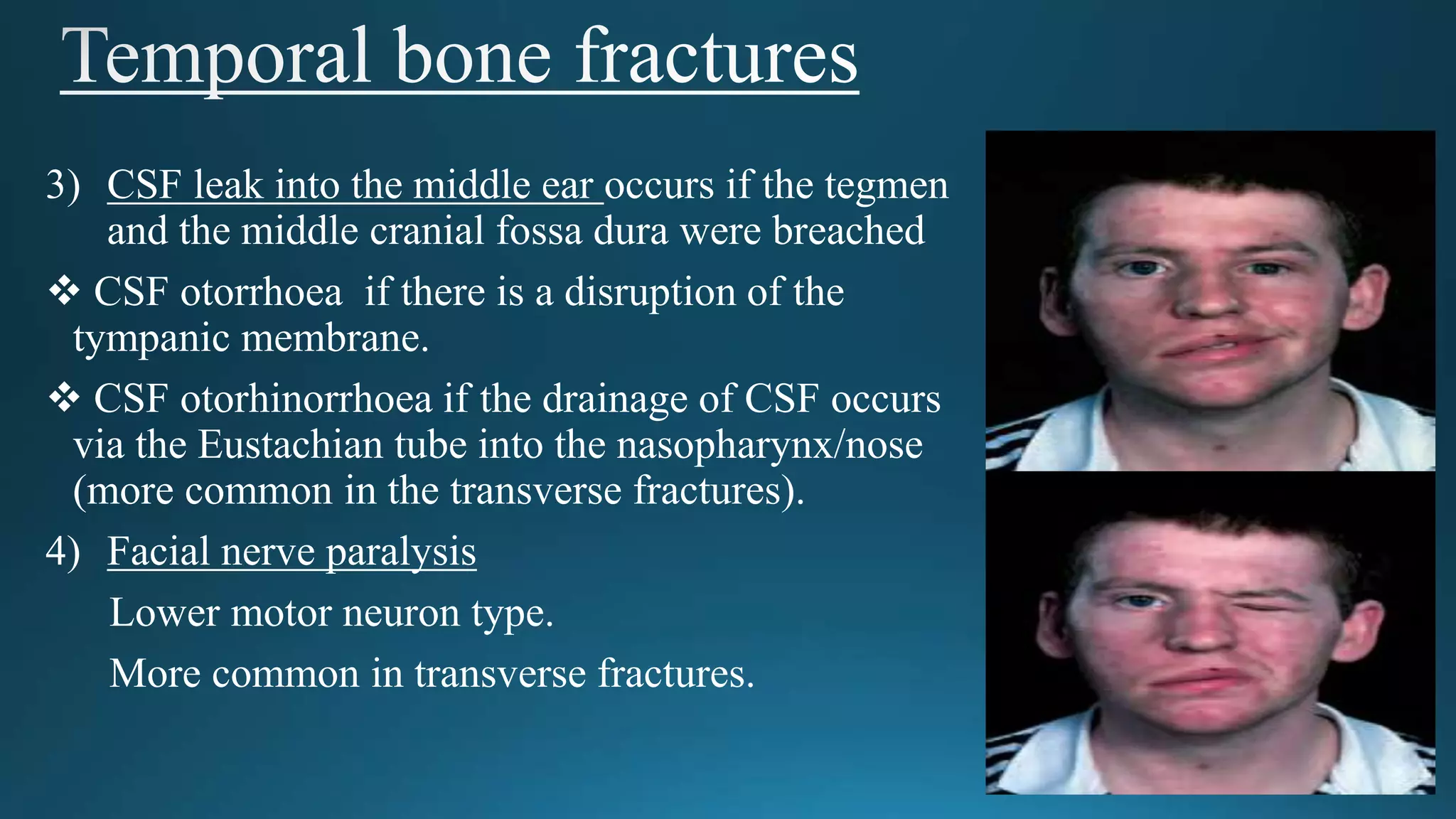 Traumatic ear | PPTX