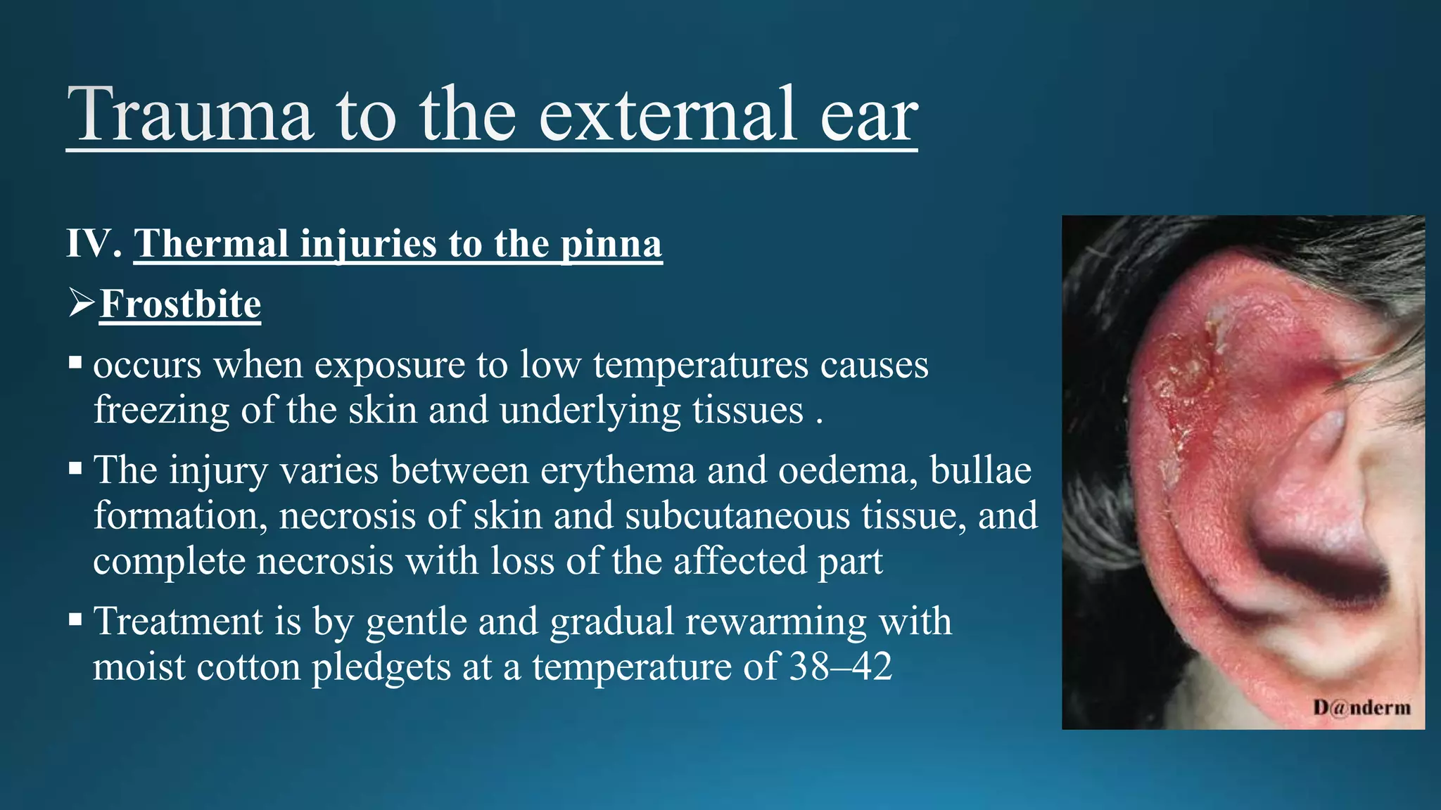 Traumatic ear | PPTX