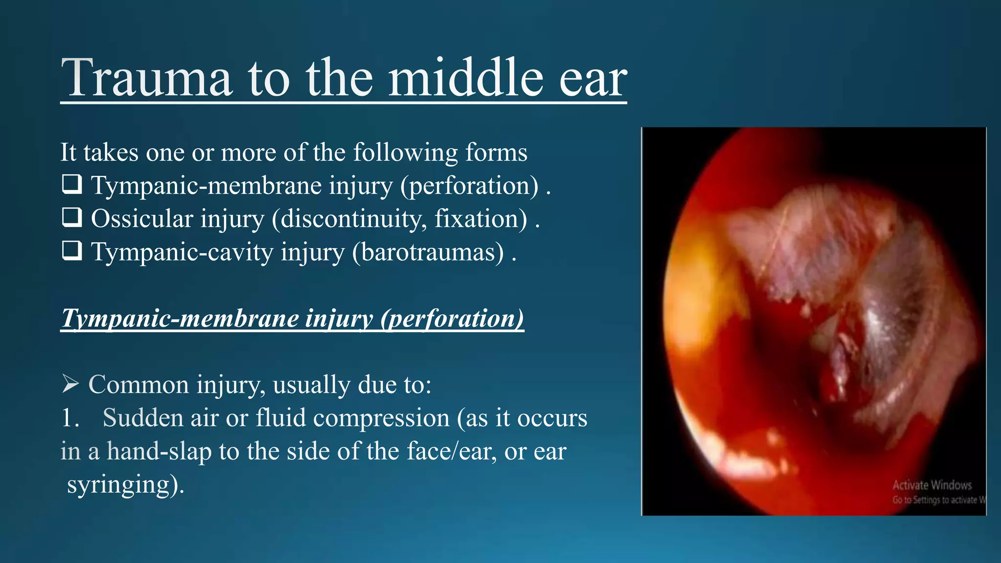 Traumatic ear | PPTX