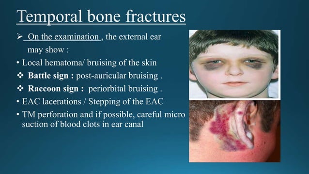 Traumatic ear | PPTX | First Aid | Injuries