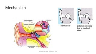 Traumatic ear conditions | PPTX
