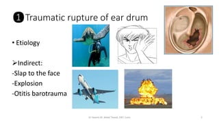 Traumatic ear conditions | PPTX