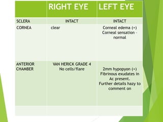 Traumatic endoph presentation 2 (1) 2222.pptx