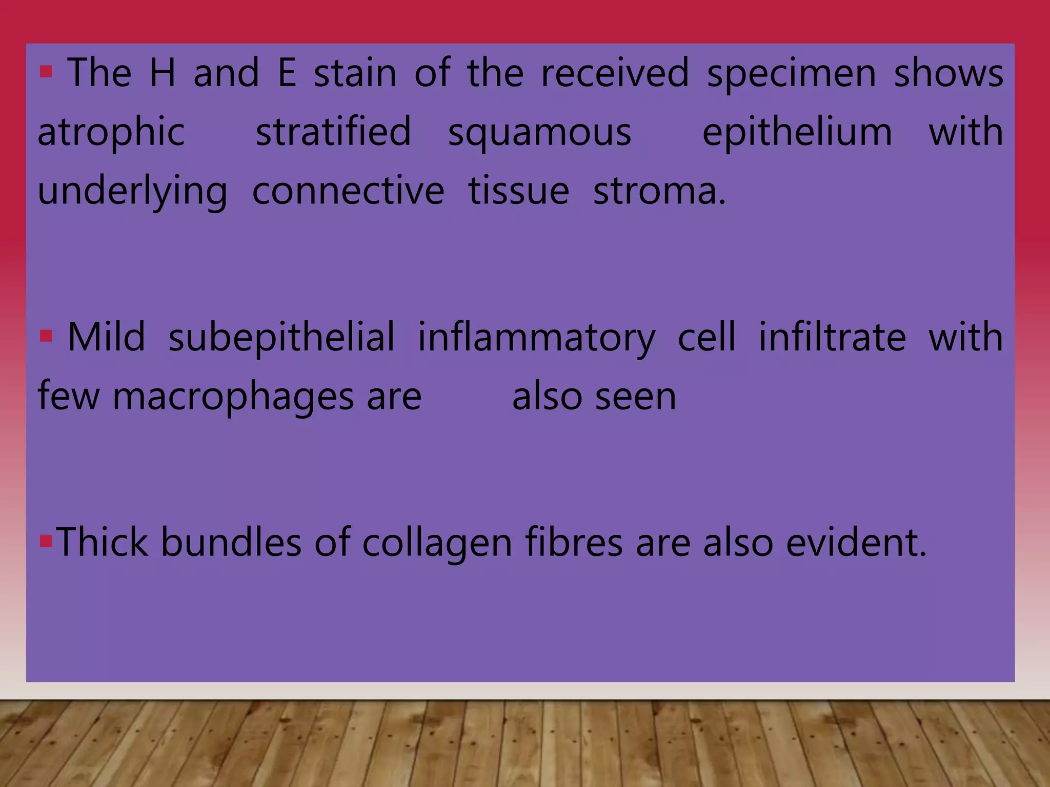 Traumatic fibroma made easy | PPTX