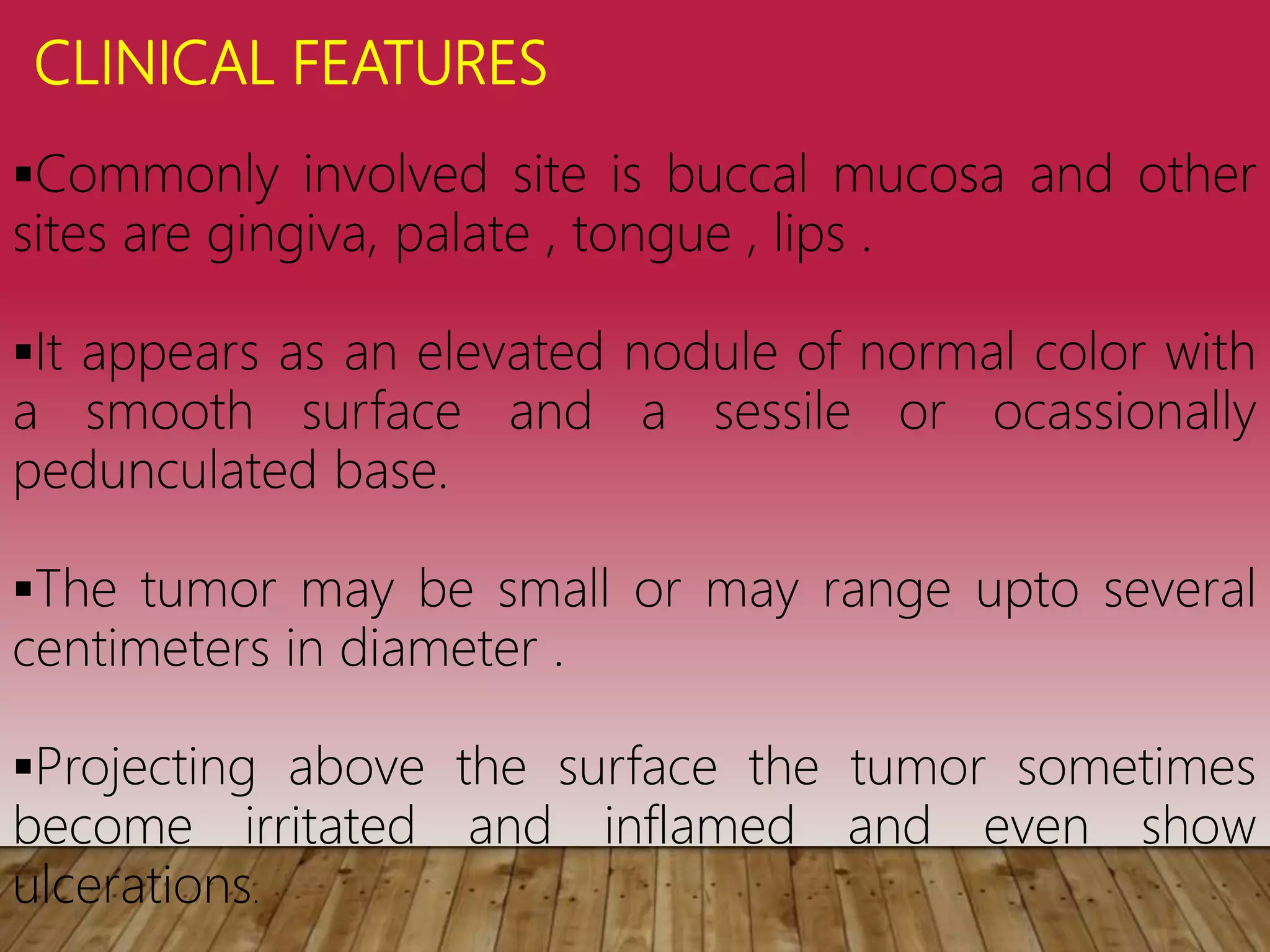 Traumatic fibroma made easy | PPTX