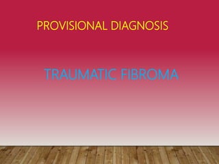 Traumatic fibroma made easy | PPTX