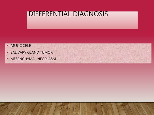 Traumatic fibroma made easy | PPTX | Ear, Nose and Throat Conditions ...