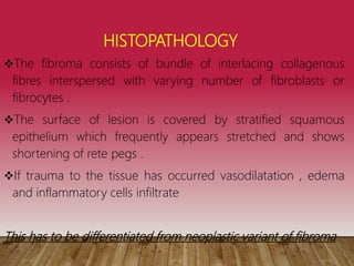 Traumatic fibroma made easy | PPTX
