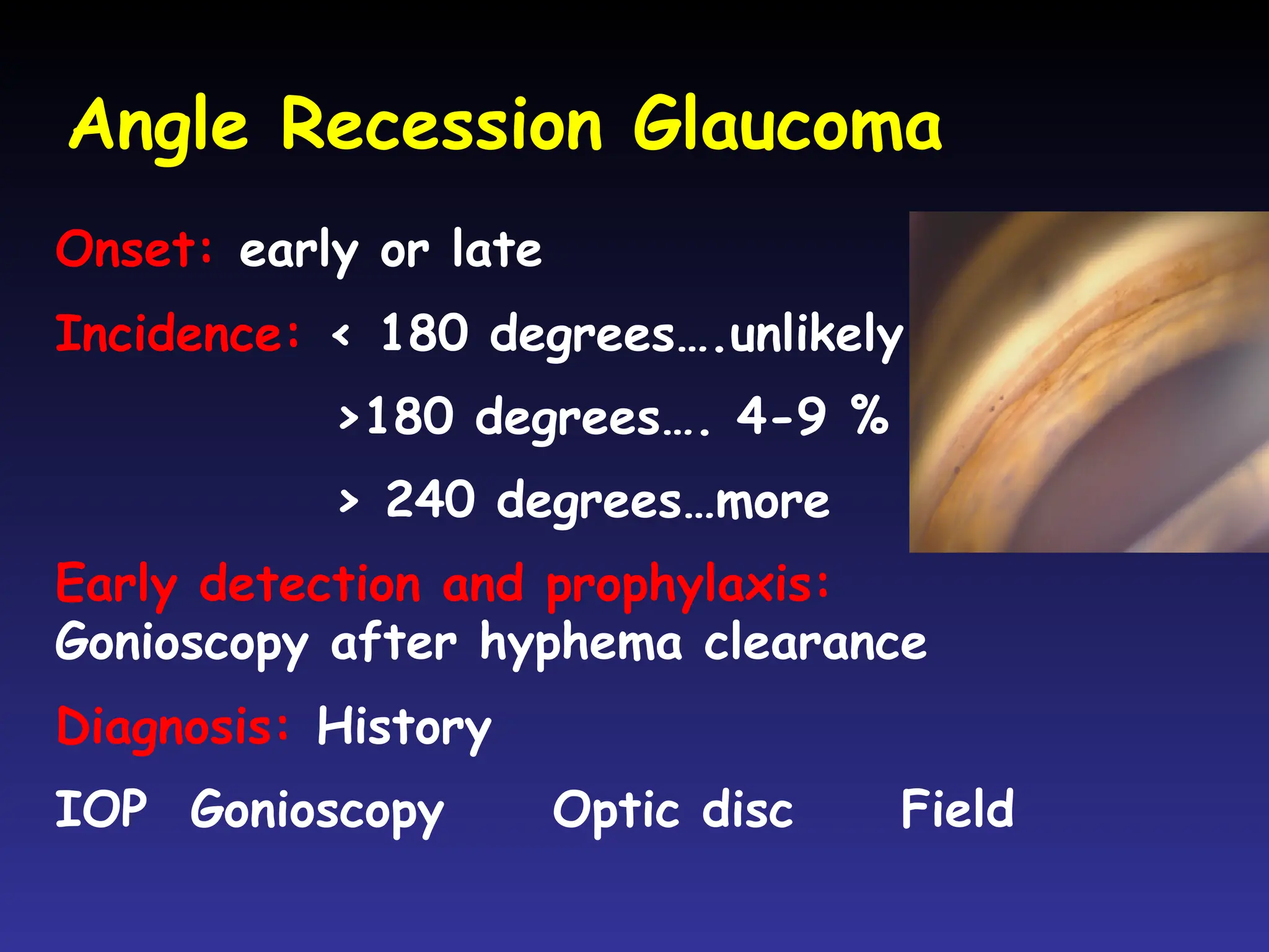 Traumatic_Glaucoma.pdf..................... | PDF