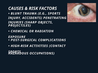 Traumatic_Glaucoma_Presentation Medical education.pdf.pptx.pptx
