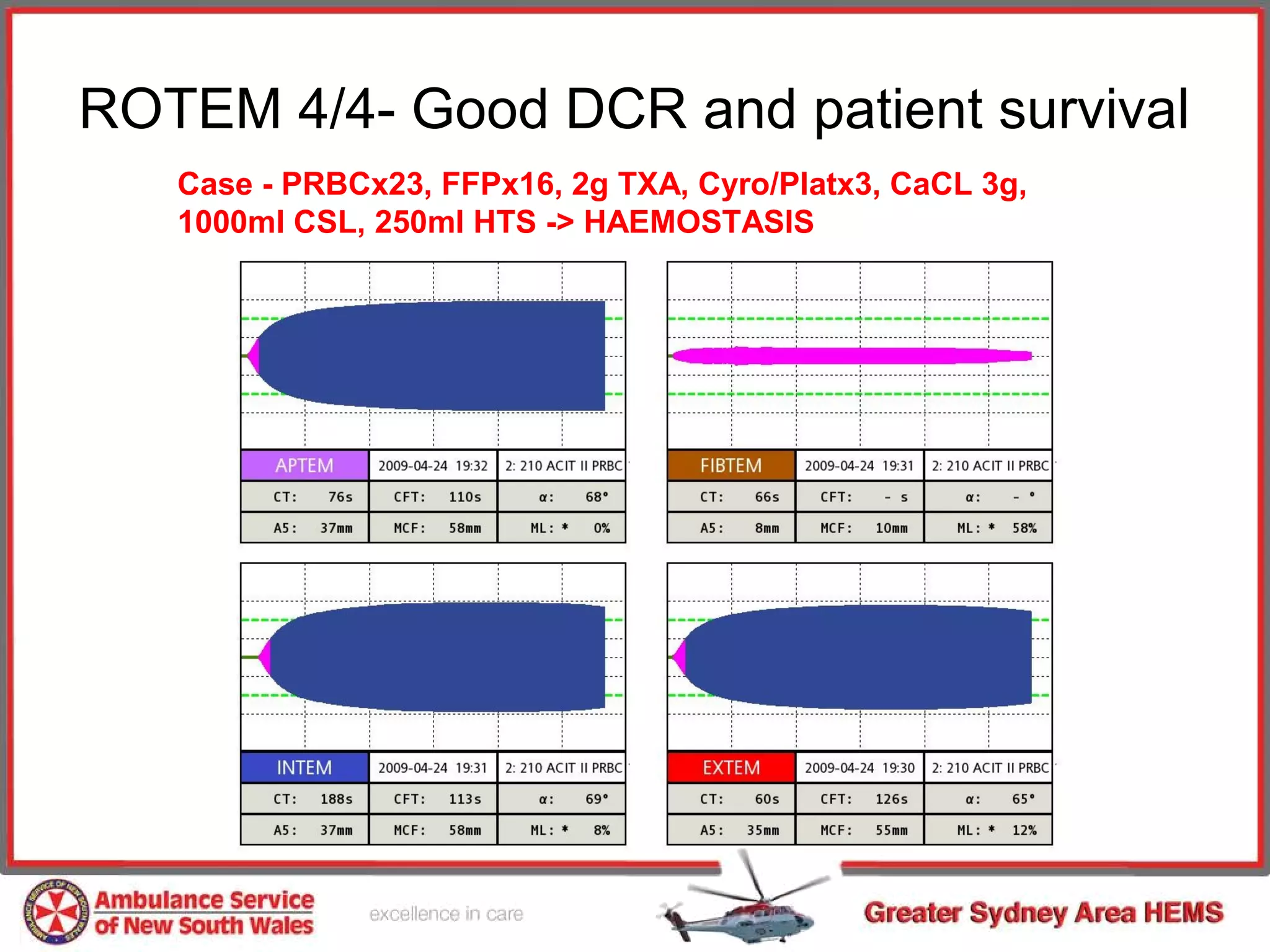 Traumatic haemorrhage | PPT