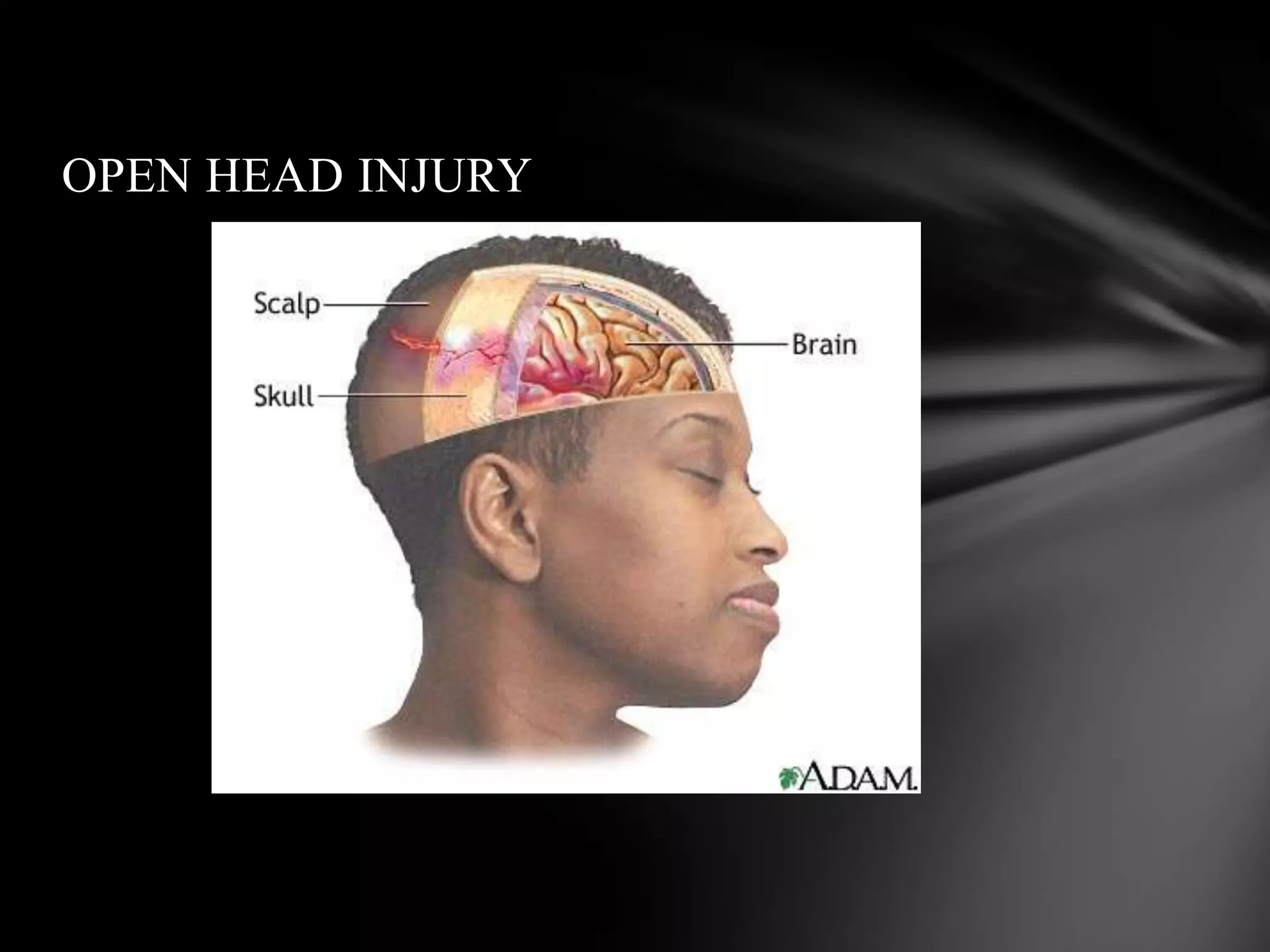 Traumatic head and spinal cord injury | PPTX