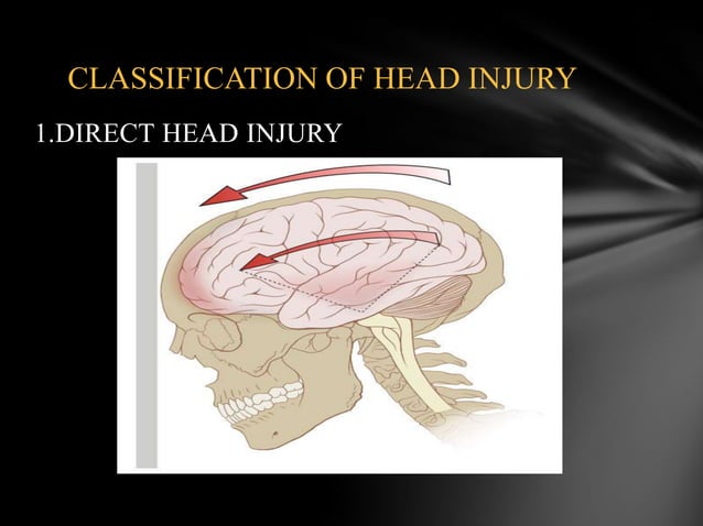 Traumatic head and spinal cord injury | PPTX | Death, Injury, or ...
