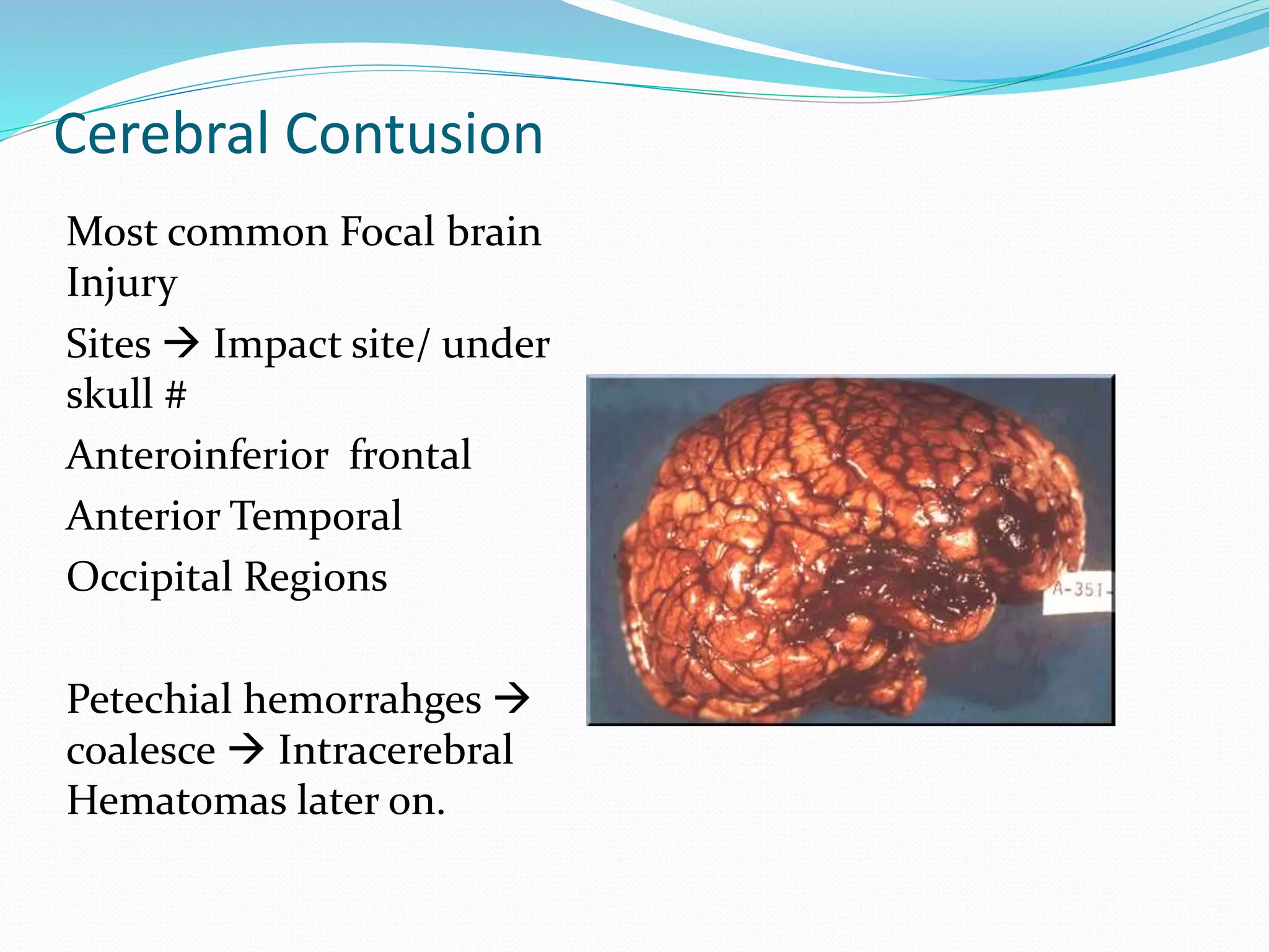 Traumatic head injury | PPTX