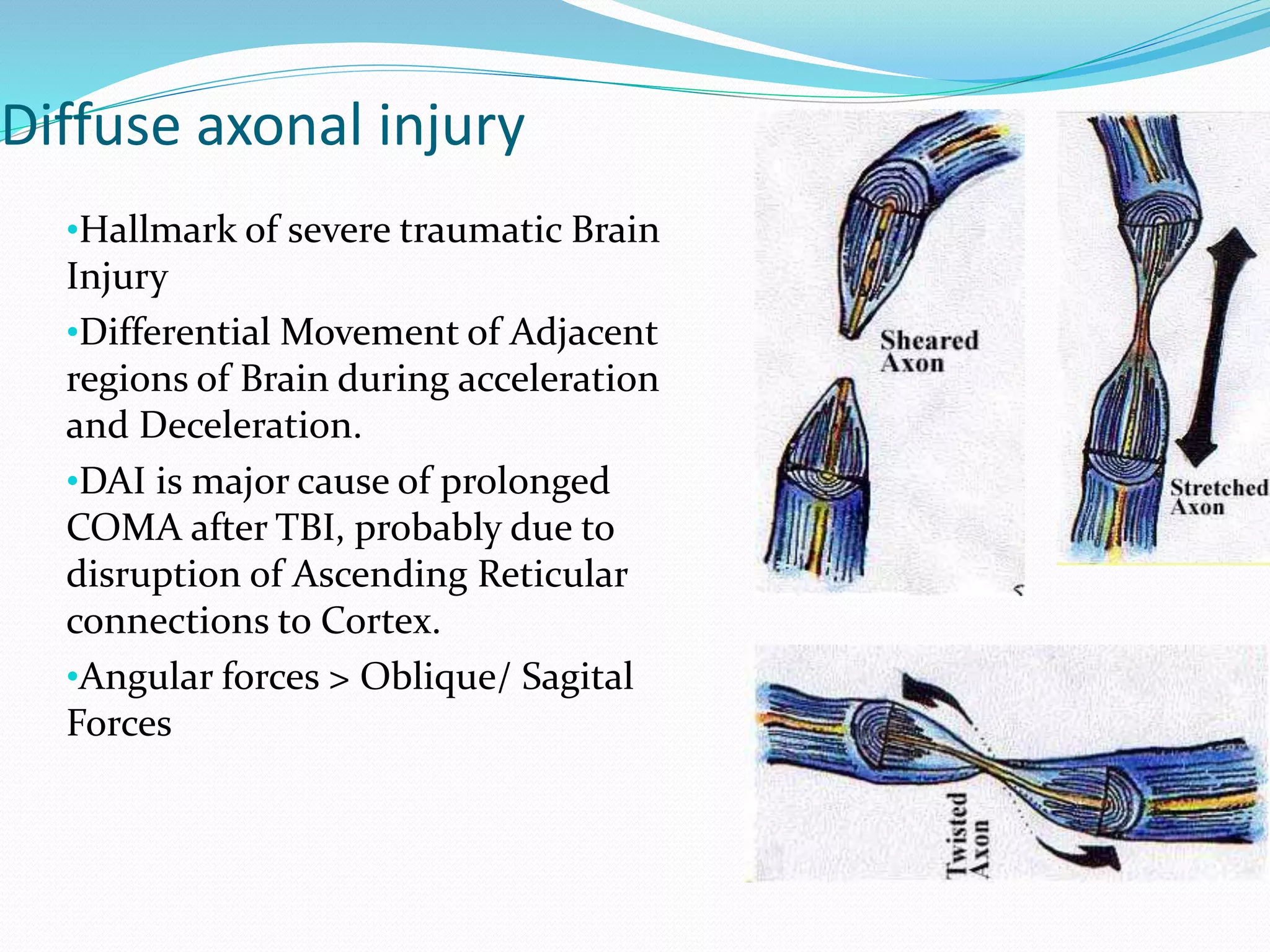 Traumatic head injury | PPTX