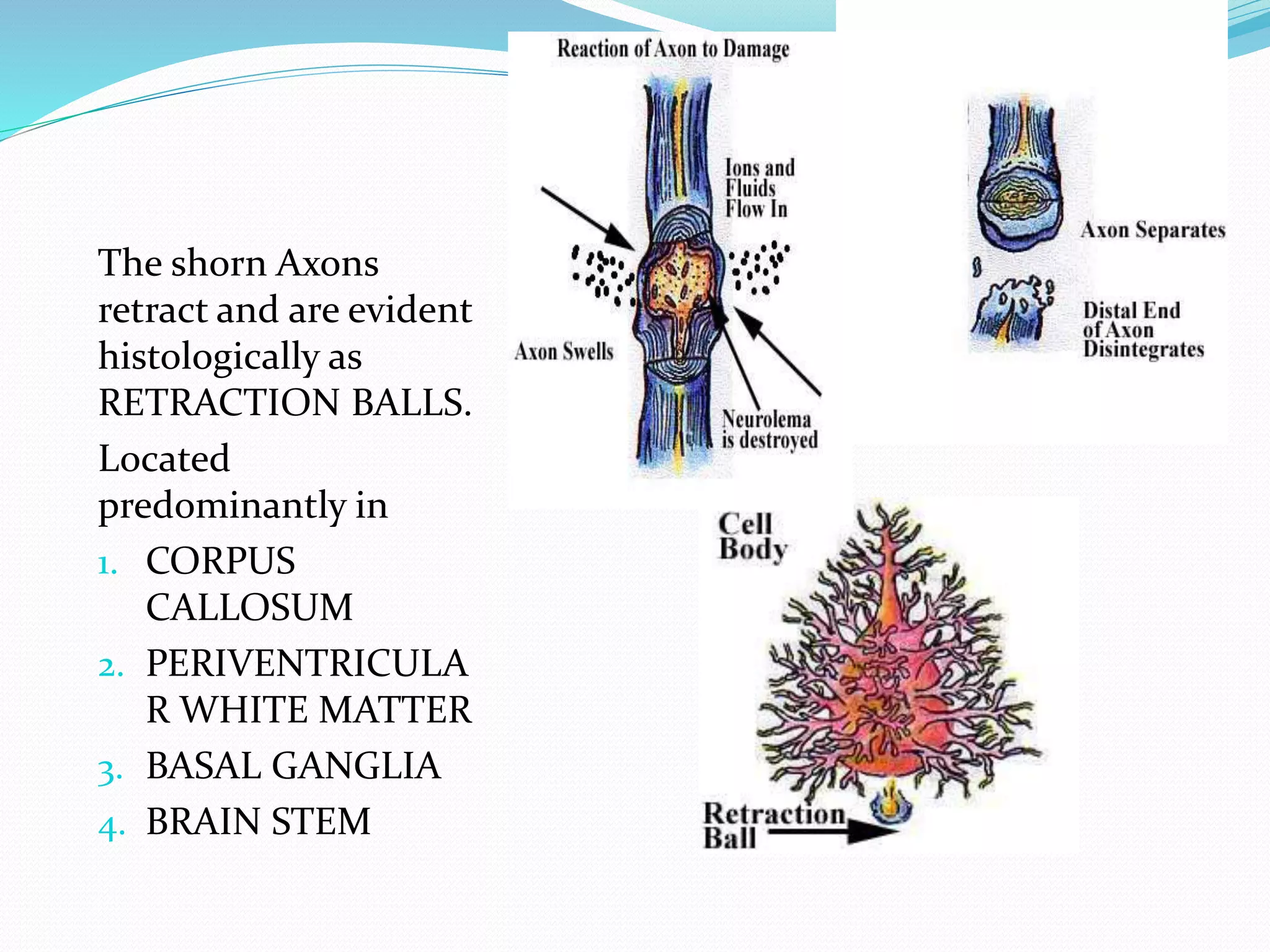 Traumatic head injury | PPTX