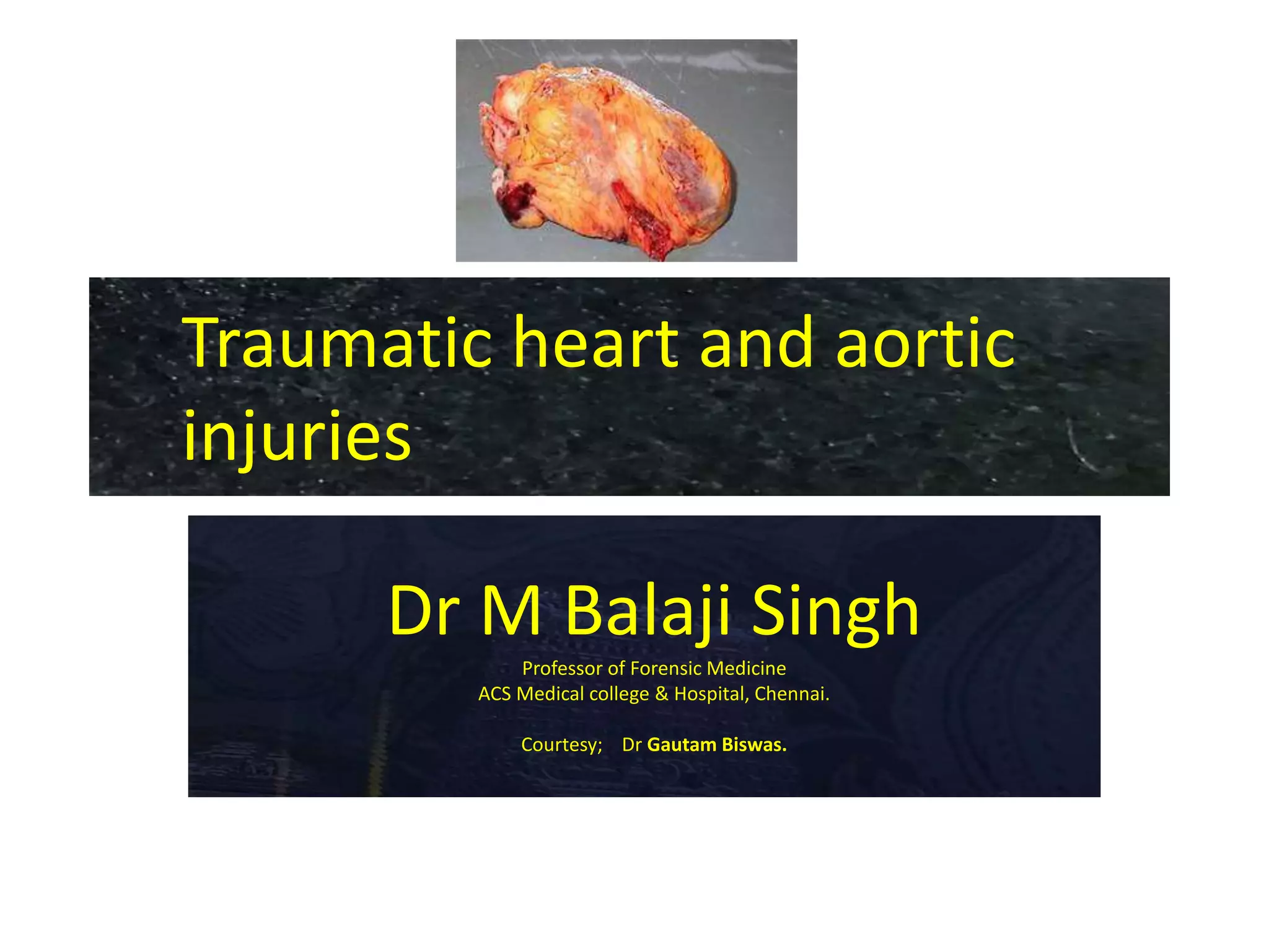 Traumatic heart injuries a brief | PPTX | Death, Injury, or Military ...