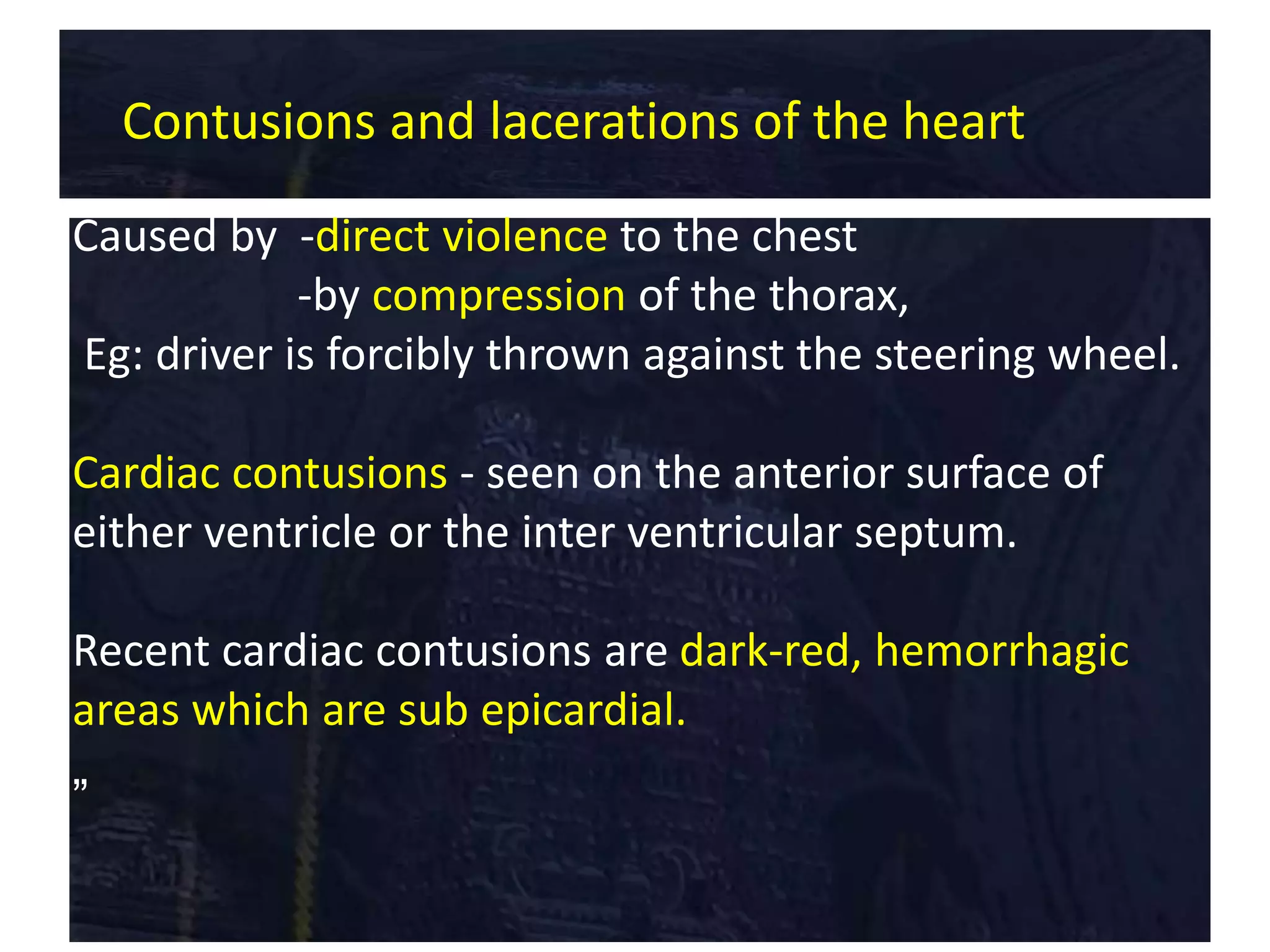 Traumatic heart injuries a brief | PPTX