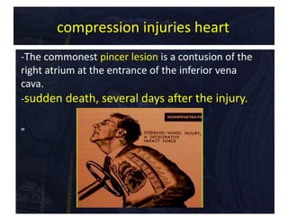 Traumatic heart injuries a brief | PPTX