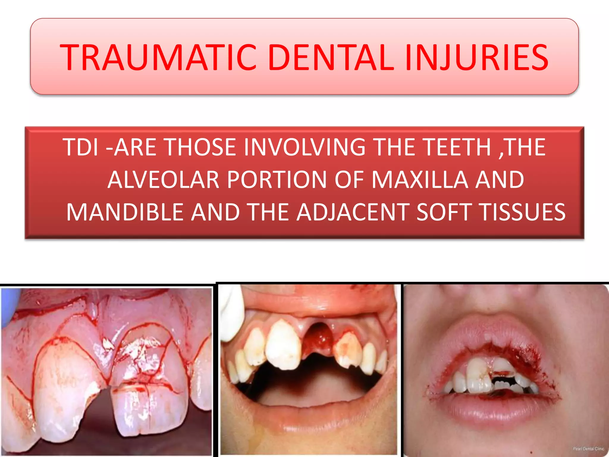 Traumatic injuries | PPTX