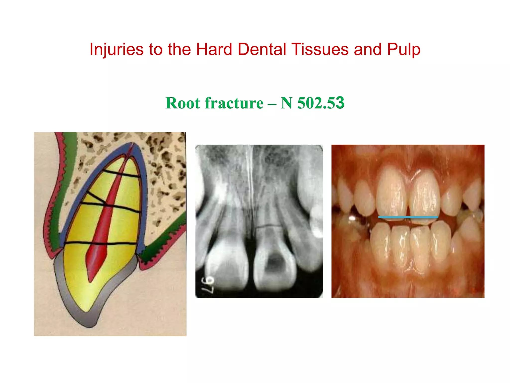 TRAUMATIC INJURIES.pptx
