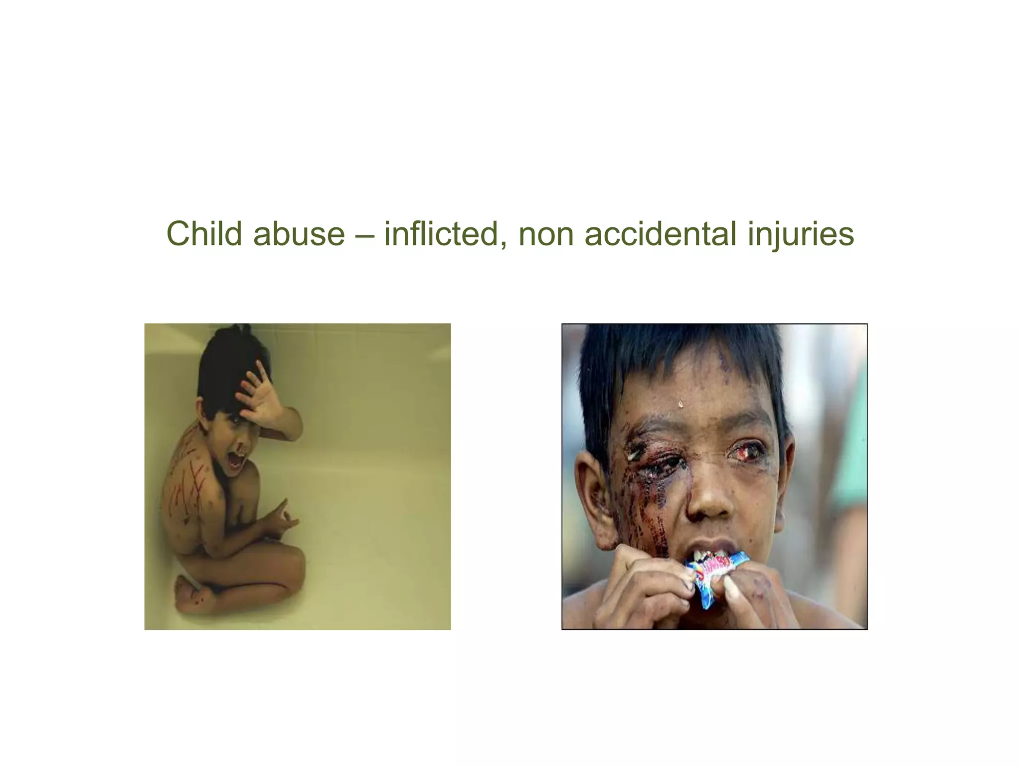 TRAUMATIC INJURIES.pptx