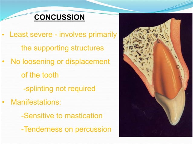 TRAUMATIC INJURIES TO THE TEETH AND SUPPORTING STRUCTURES | PPT | Death ...