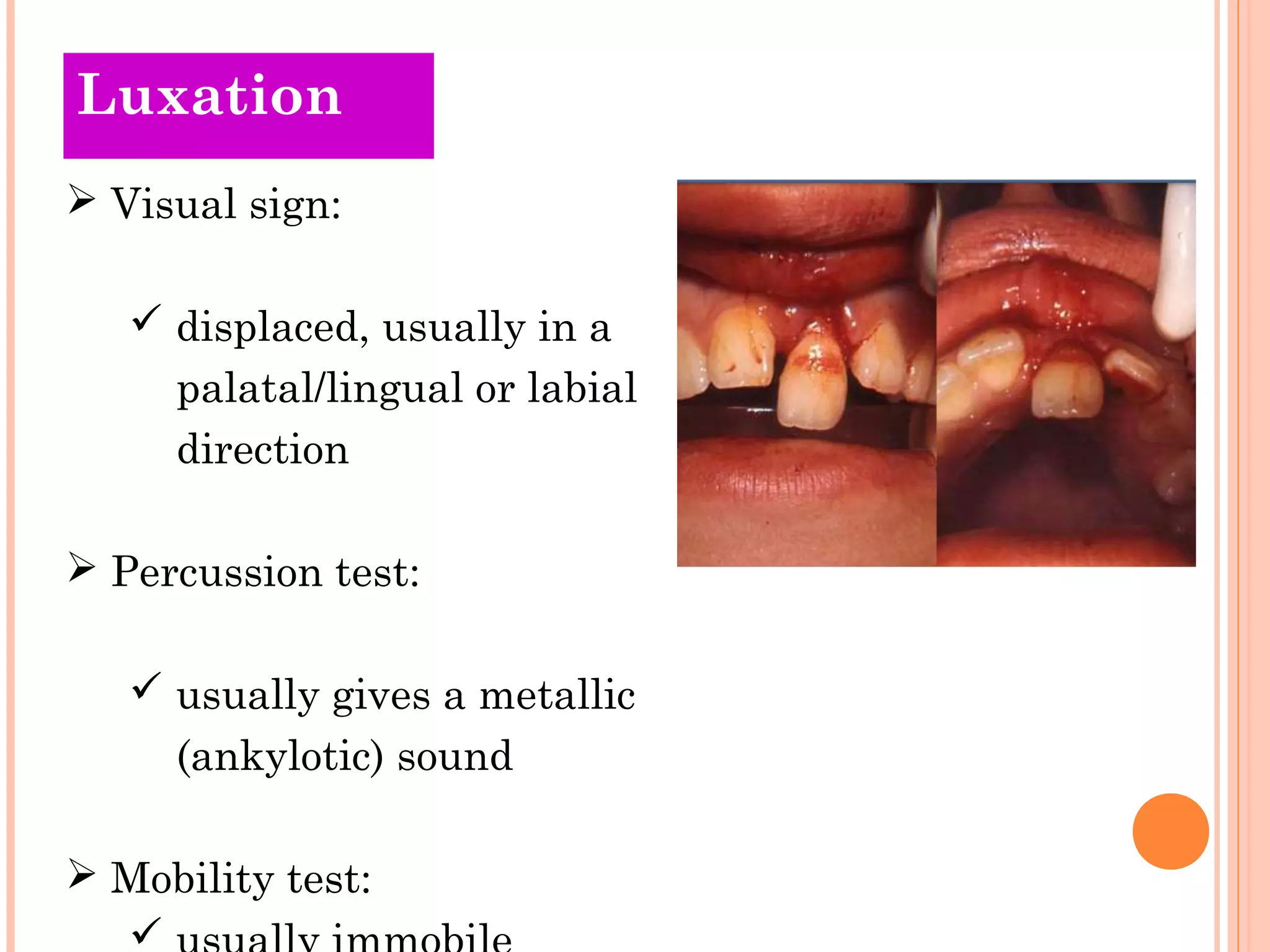 Traumatic injuries of teeth | PPT