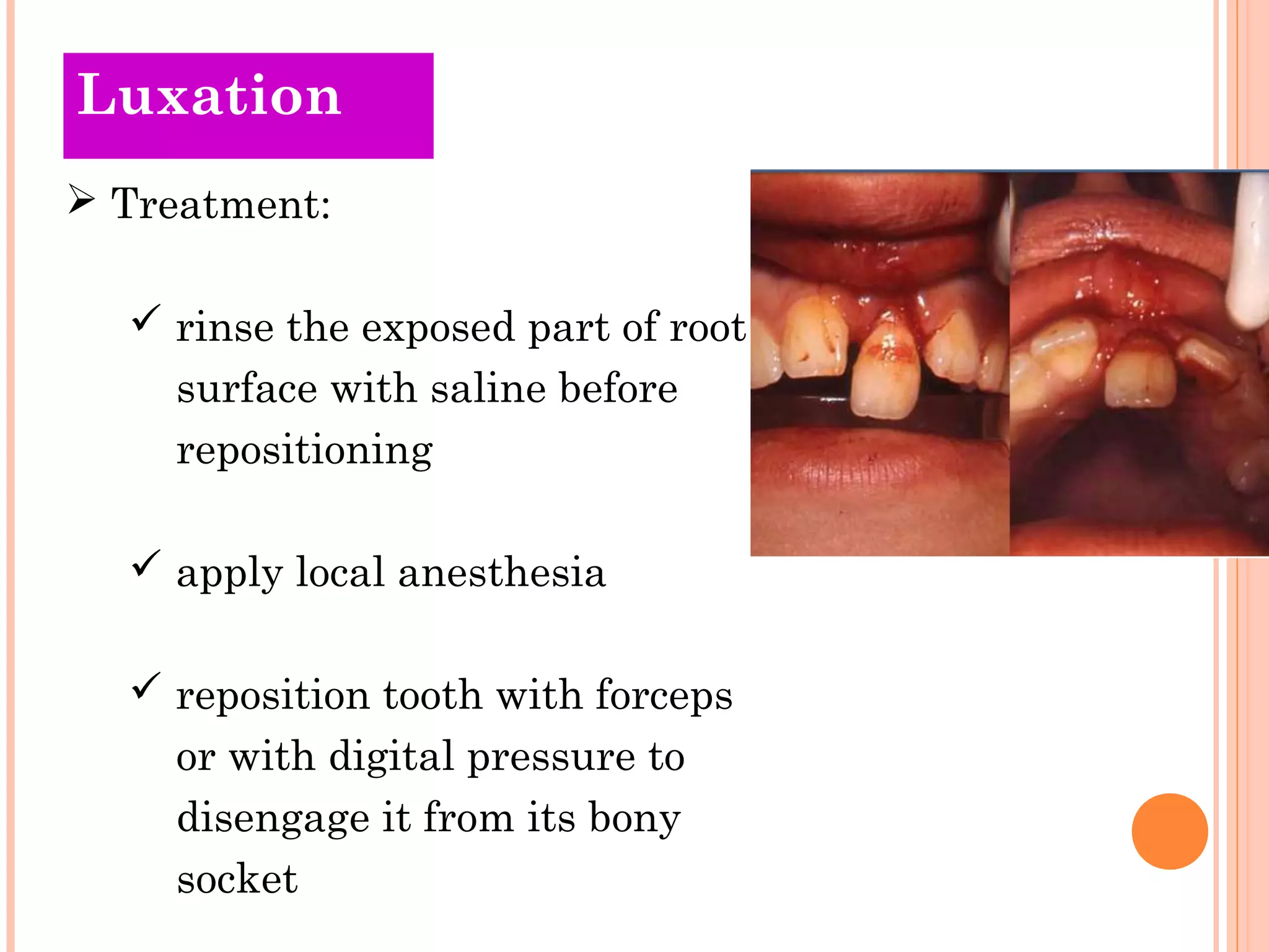Traumatic injuries of teeth | PPT