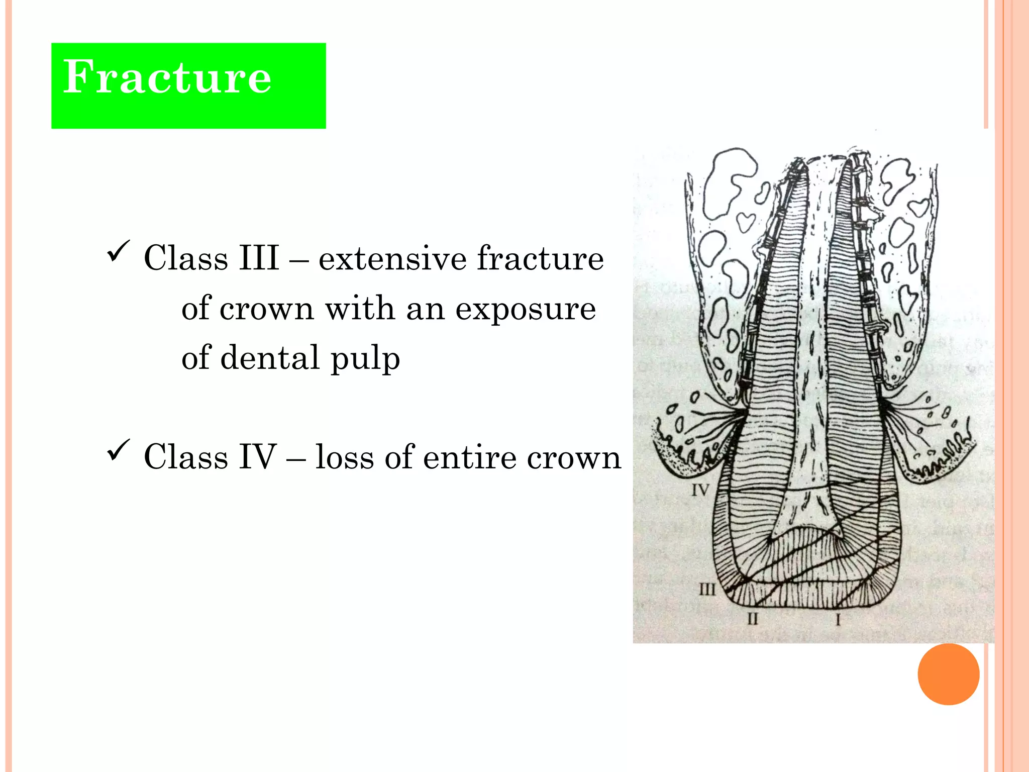 Traumatic injuries of teeth | PPT