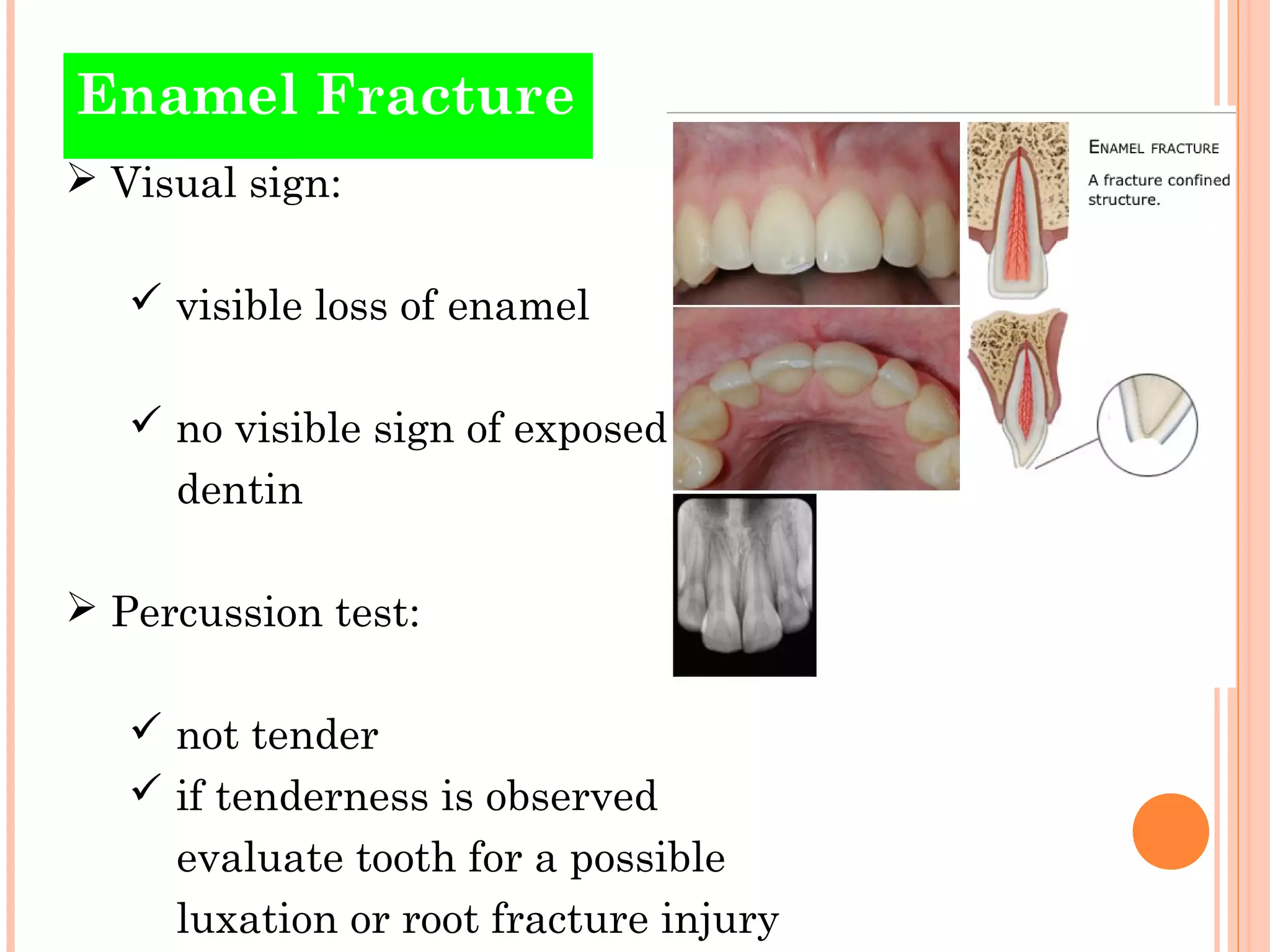 Traumatic injuries of teeth | PPT