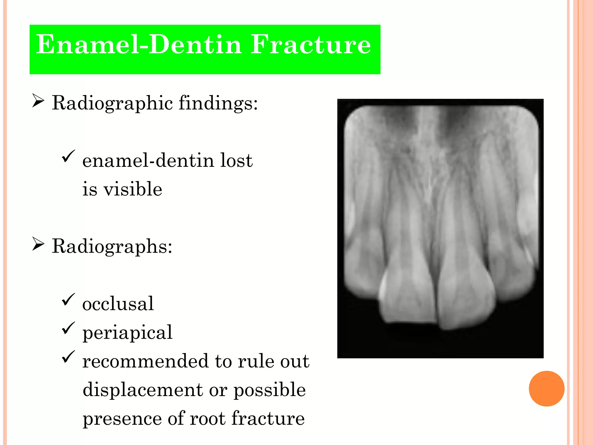 Traumatic injuries of teeth | PPT