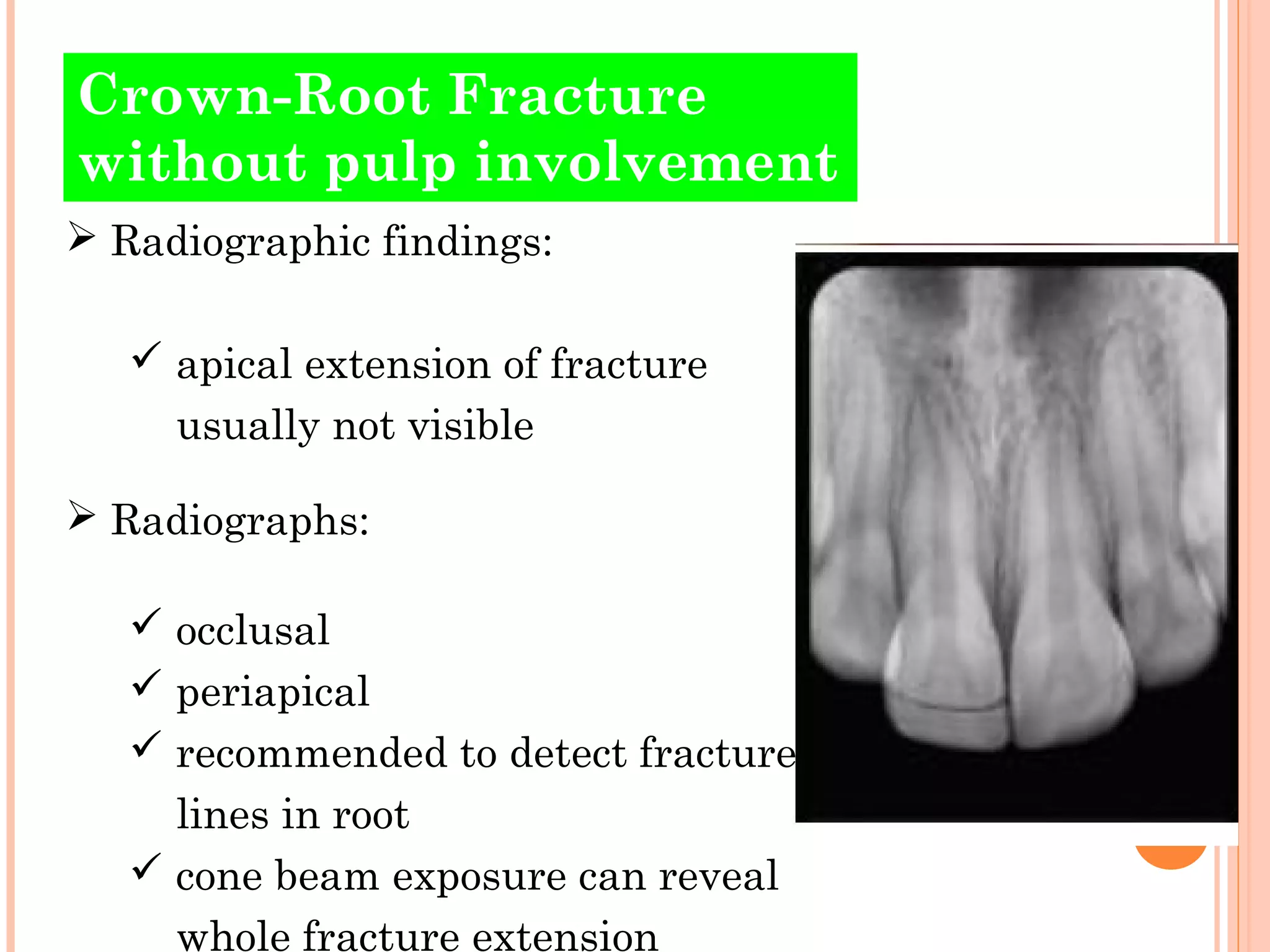 Traumatic injuries of teeth | PPT
