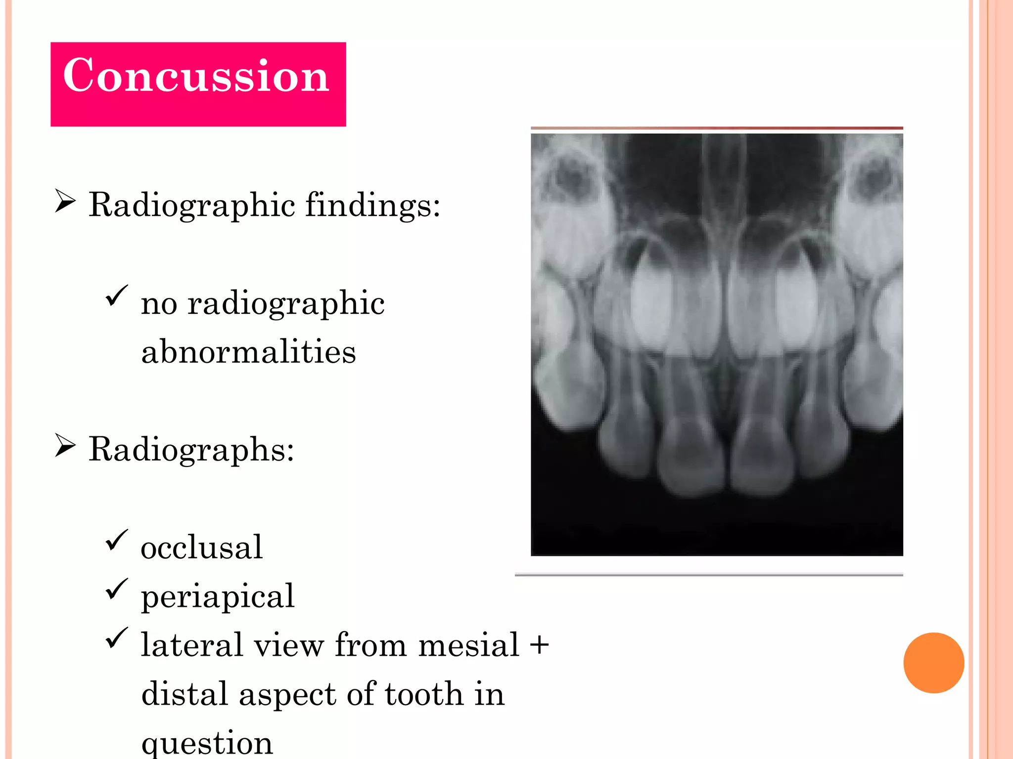 Traumatic injuries of teeth | PPT
