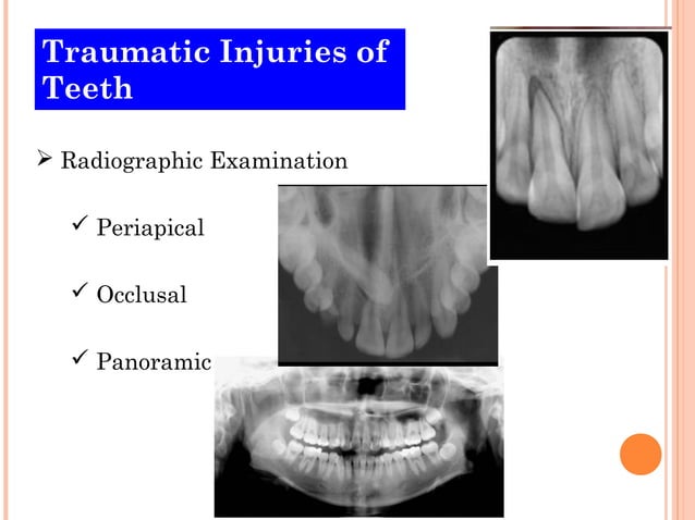 Traumatic injuries of teeth | PPT | Dental Health | Diseases and Conditions