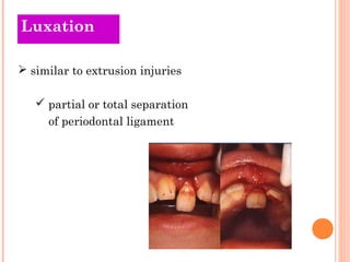 Dental Trauma Guidelines PDF Tooth Enamel Dental Anatomy, 42% OFF