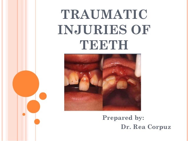 Traumatic injuries of teeth