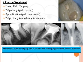 Traumatic injuries of teeth | PPTX