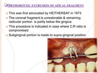 Traumatic injuries of teeth | PPTX