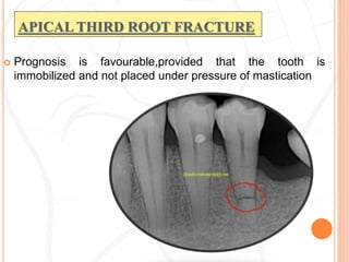 Traumatic injuries of teeth | PPTX