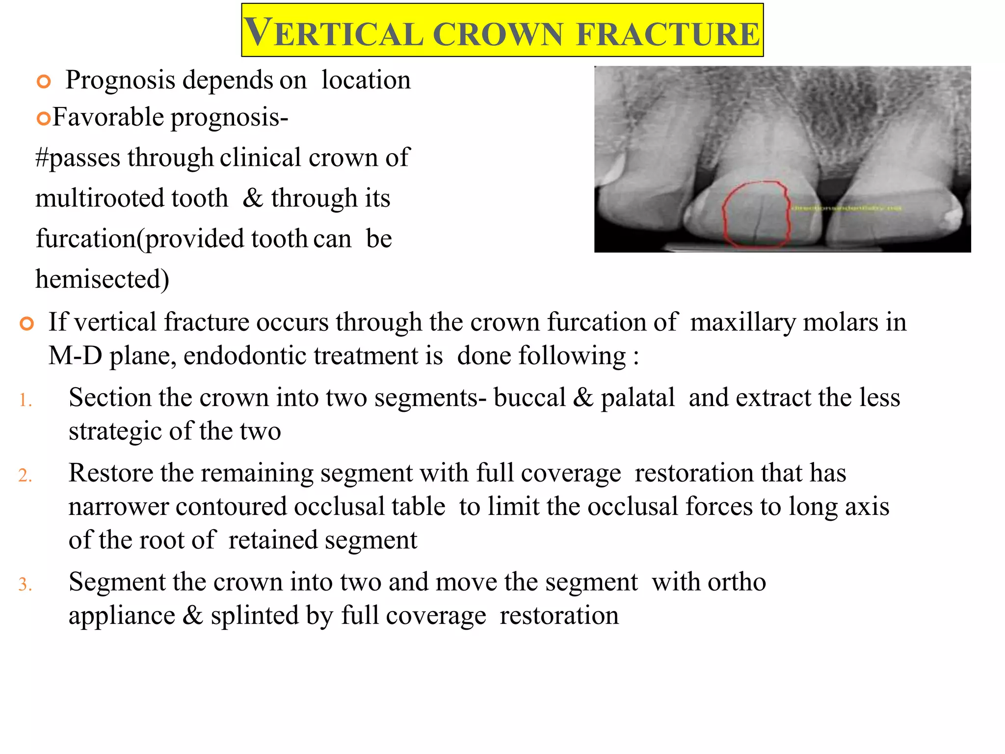 Traumatic injuries of teeth | PPTX