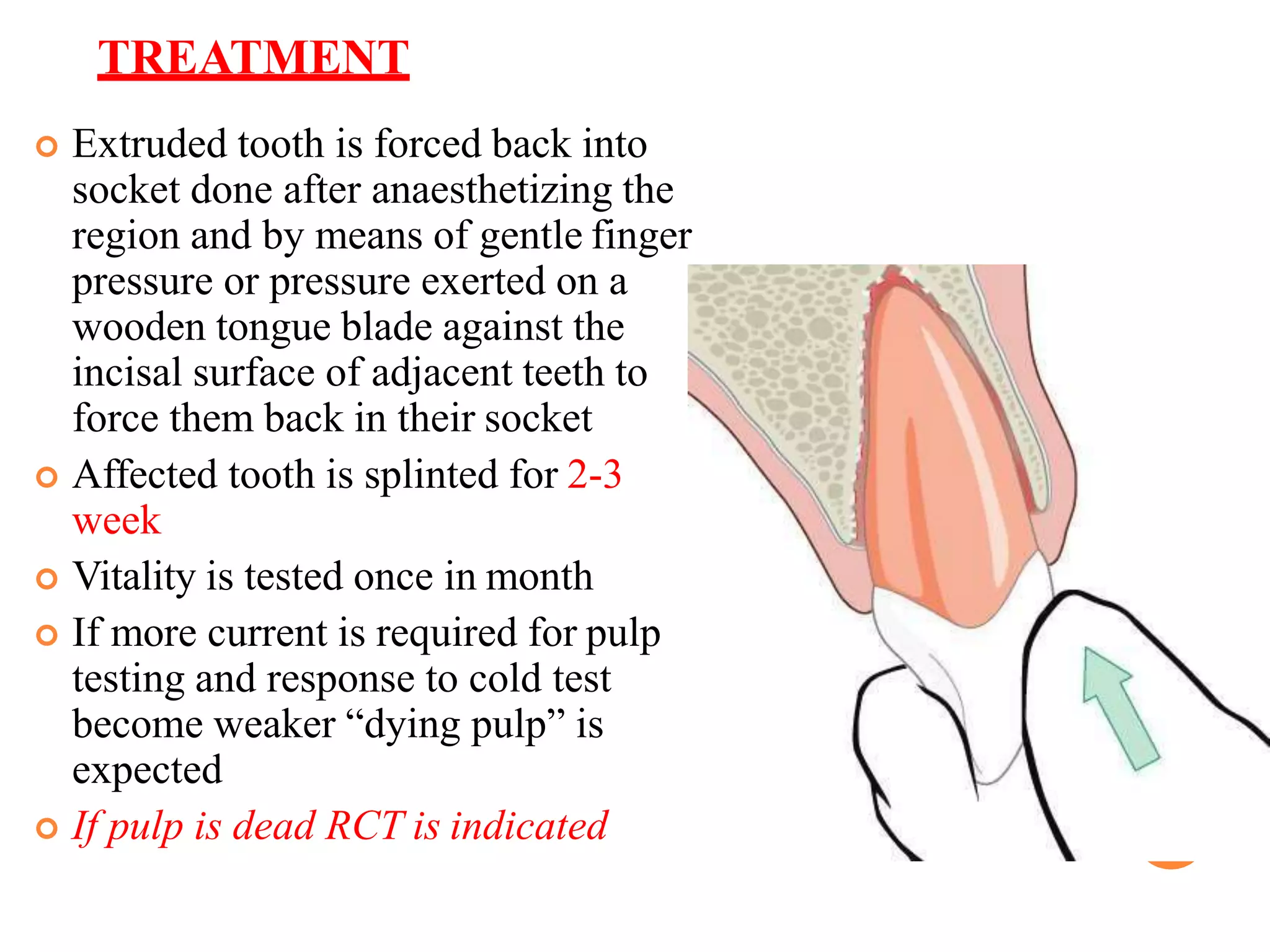 Traumatic injuries of teeth | PPTX
