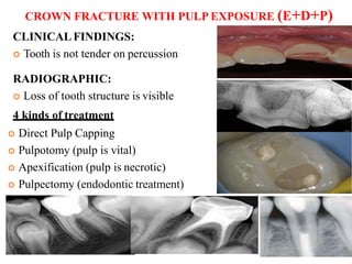 Traumatic injuries of teeth | PPTX