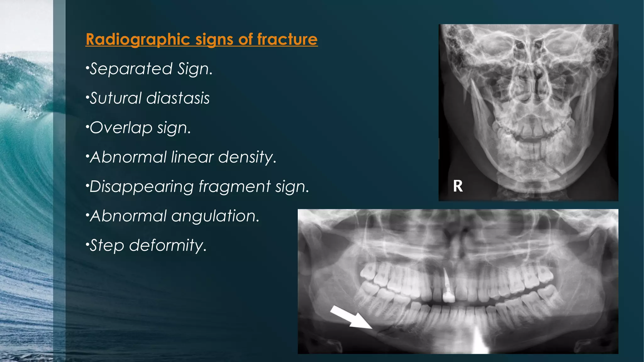 Traumatic injuries of the face and jaws | PPT