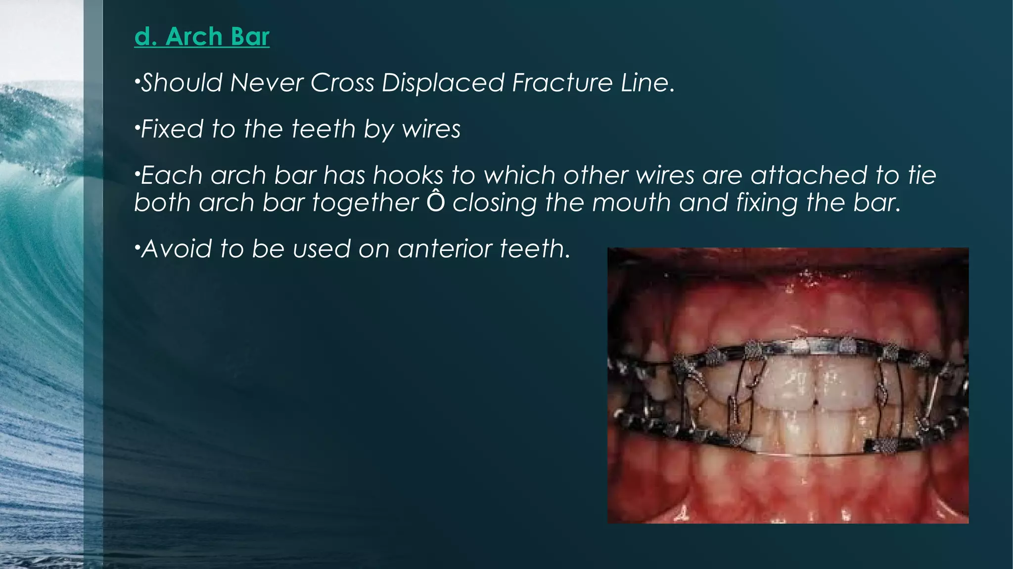 Traumatic injuries of the face and jaws | PPT